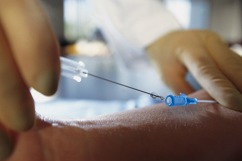 Milestones in Infusion Therapy