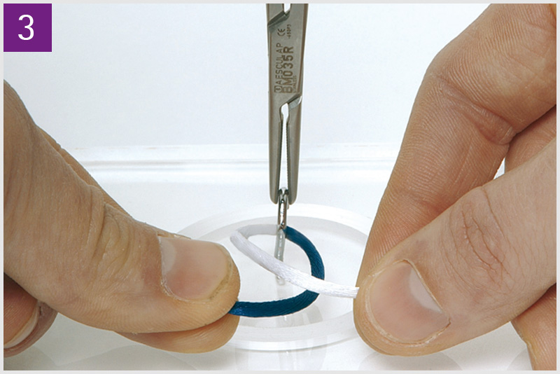 Ligation around haemostatic clamp (Common technique)