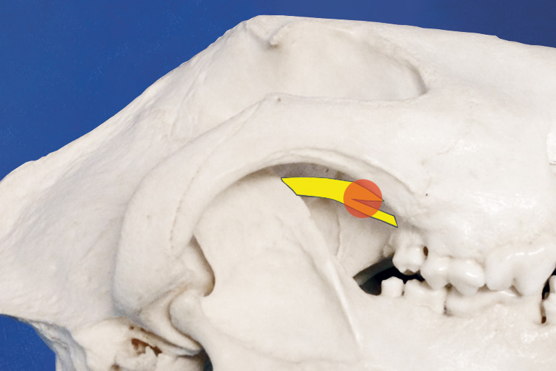 Maxillary Nerve Block