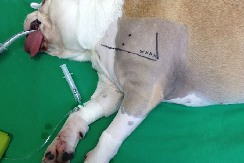 Brachial Plexus Block