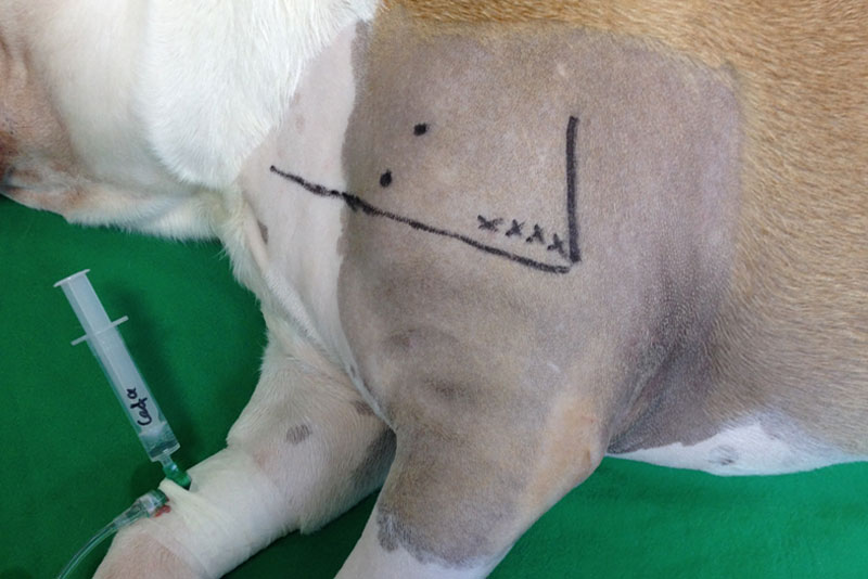 Brachial Plexus Block